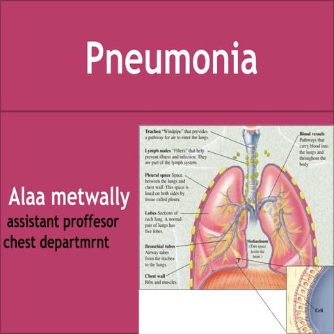 Pneumonia 5th year | PPT