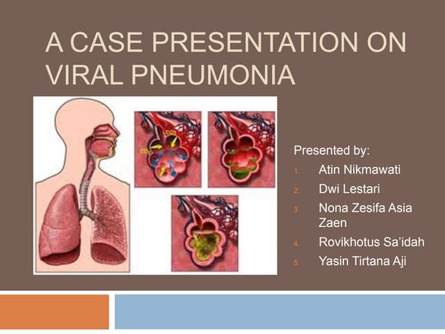 Septicemia | PPTX | Blood Disorders | Diseases and Conditions
