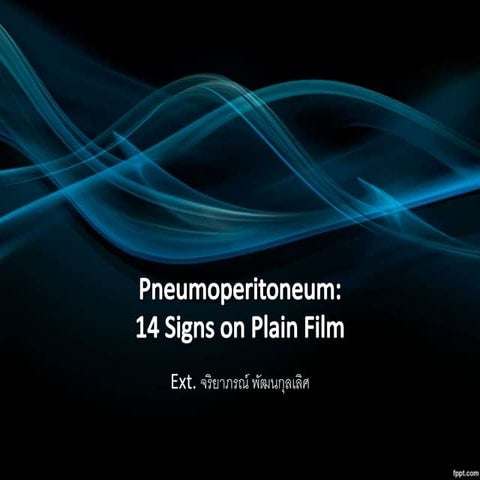 Comprehensive Overview of Pneumoperitoneum: Causes, Diagnosis, and ...