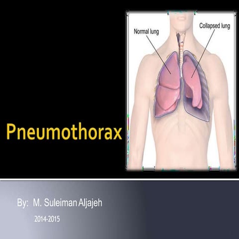 Pneumothorax 141221114833 Conversion Gate02 Pptx