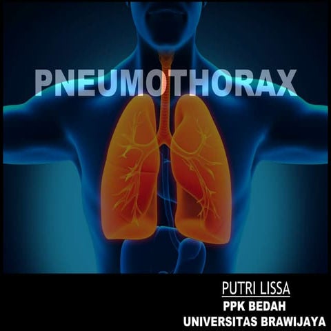 Pneumothorax Lisa Pptx Macam Dan Jenis Pneumothorax Pptx