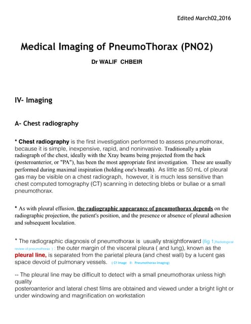 PNEUMOTHORAX IN CHEST XRAY INTERPRETATIONpptx | PPTX