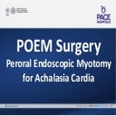 POEM Procedure for Achalasia Cardia - PDF.pdf
