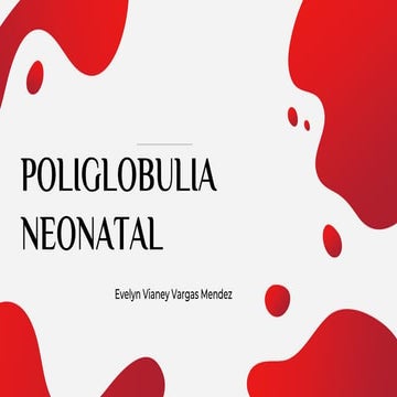 poliglobulia neonatal.pptx