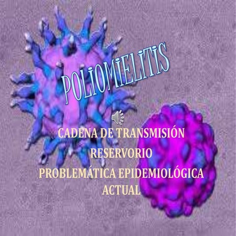 Poliomielitis. | PPTX