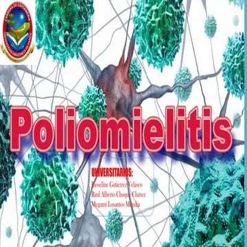 QUE ES LA POLIOMIELITIS O POLIO.CHBVNBCNSBCN | PPTX