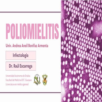 Poliomielitis | PPTX