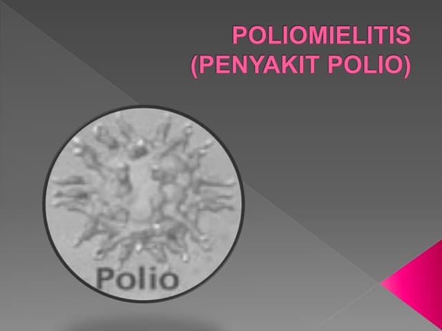 Mind Map Poliomielitis aaa bbb ccc dddddd | PPTX