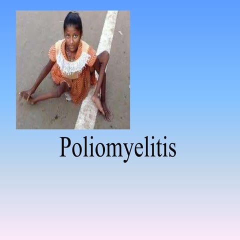 Poliomyelitis | PPTX