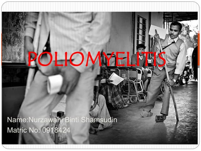 Poliomyelitis | PPTX