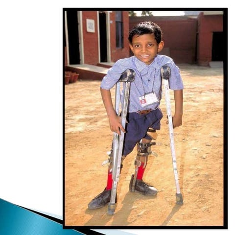 poliomyelitis-1908102.........00943.pptx