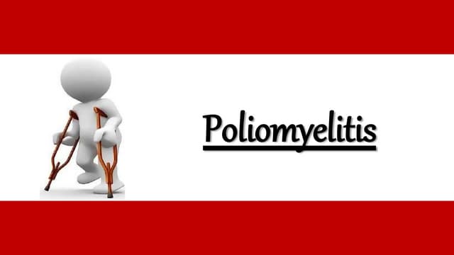 Poliomyelitis | PPTX