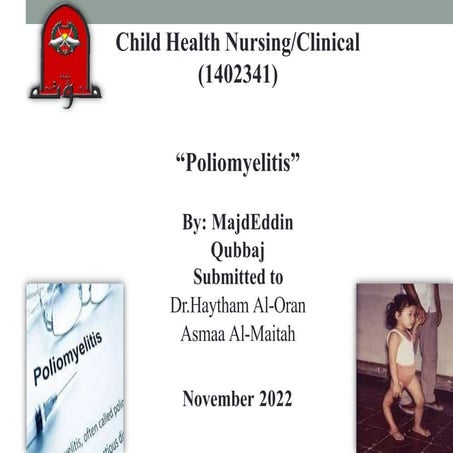 poliomyelitis مجد الدين.pptx