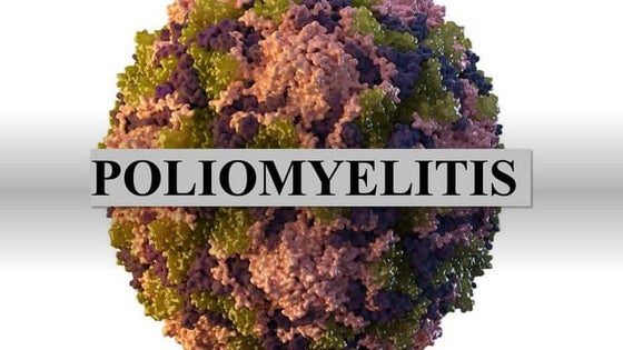 Pulse polio programme.pptx