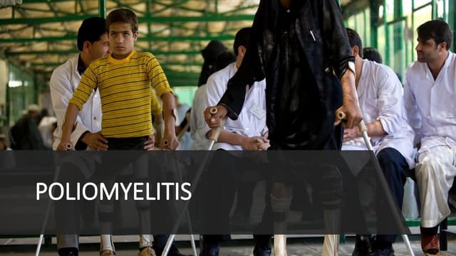 Poliomyelitis | PPTX