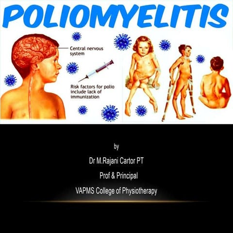 Poliomyelitis | PPTX