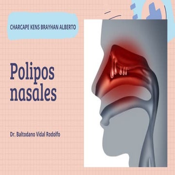 Polipos nasales, presentacion resumida.pdf