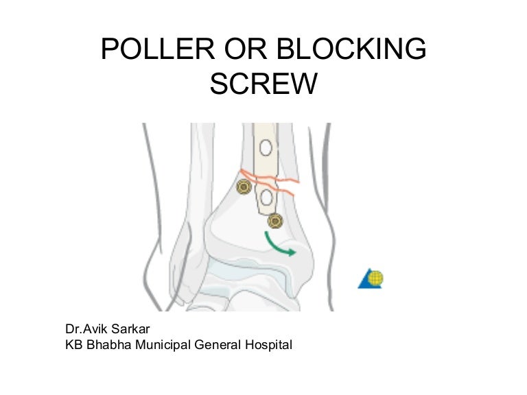 Poller or blocking screw