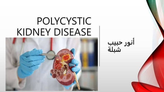 Polycystic kidney disease | PDF