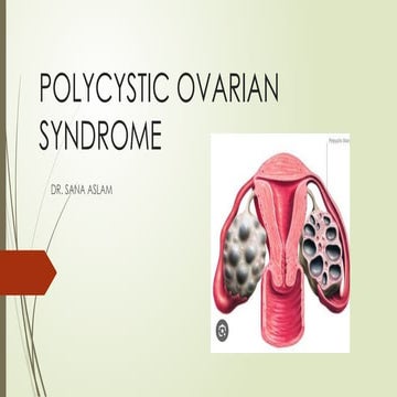 Polycystic Ovarian Syndrome Presentation Pptx