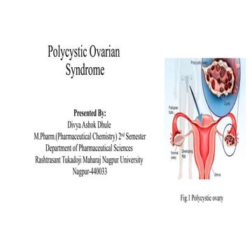 polycystic Ovary Syndrome all details.pptx