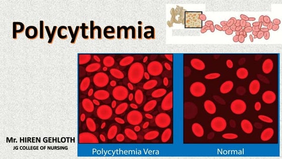 Pathophysiology of polycythemia | PDF
