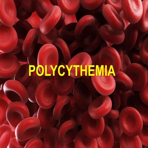 Polycythemia | PPTX