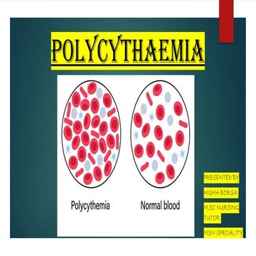 Comprehensive Overview of Polycythaemia: Types, Causes, and Management ...