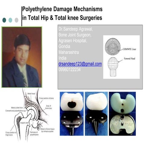 Polyethylene Damage Mechanisms in Total Hip & Total knee Surgeries ,DR ...