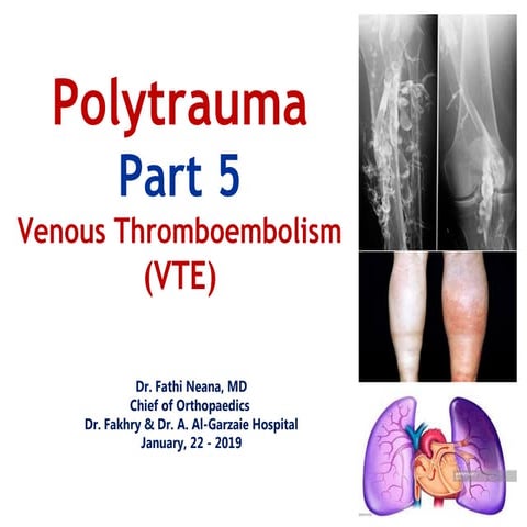 Polytrauma part 5 (VTE) | PPT