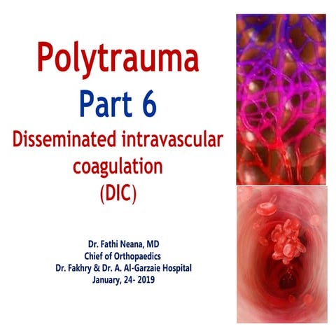 Polytrauma part 6 (DIC) | PPT