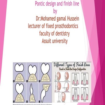 Pontic design and finish line.pptx