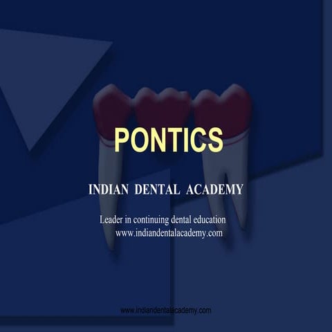 Pontics in Fixed Partial Dentures | PPT