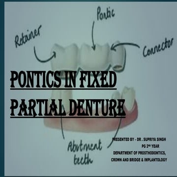 PONTICS as a part of fixed partial denture | PPTX