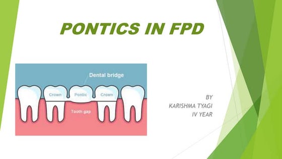 Pontics in Fixed Partial Denture | PPTX
