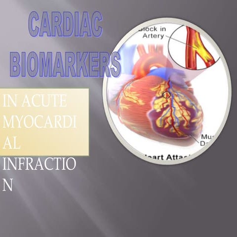 Acute Myocardial Infarction detailed slides.ppt
