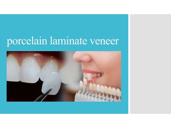 Veneers(1).pptx