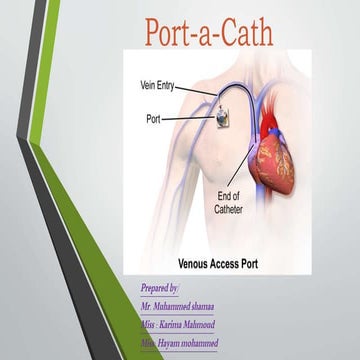 Porta Catheter Placement