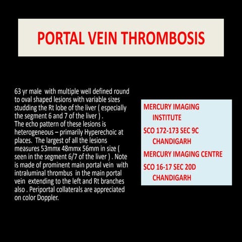 Portal vein thrombosis | PPTX