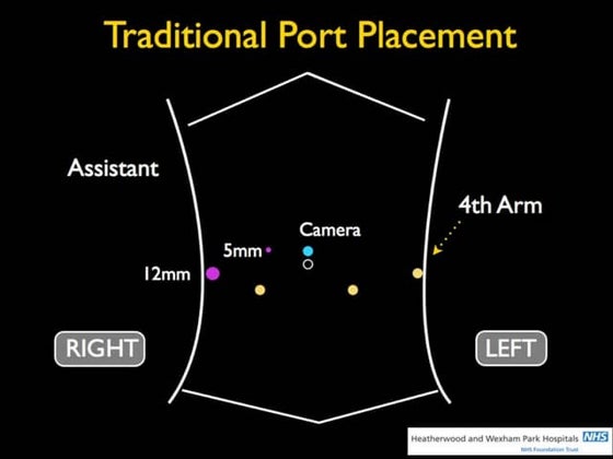 Patient positioning | PPT