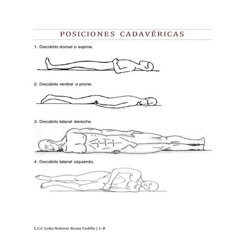 Criminalística: posiciones cadavéricas | DOCX