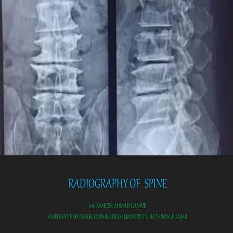 Radiographic anatomy and views of c spine | PPTX