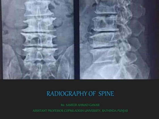 C spine positioning | PPT