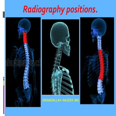 Mandible and maxilla oblique radiography | PPTX