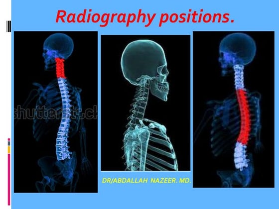 Radiographic positioning of Upper limb (ELBOW & HUMERUS) | PPT