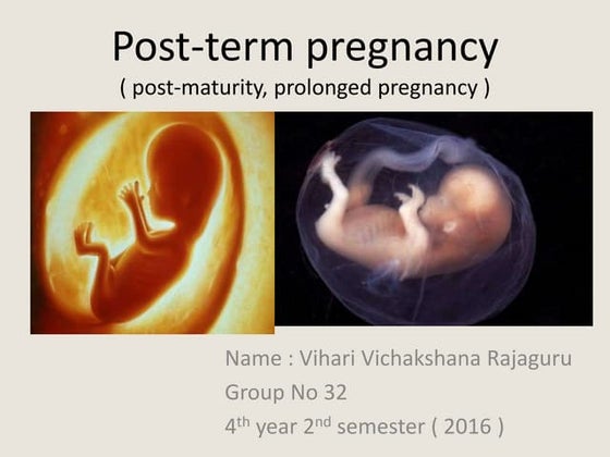 Post maturity | PPTX
