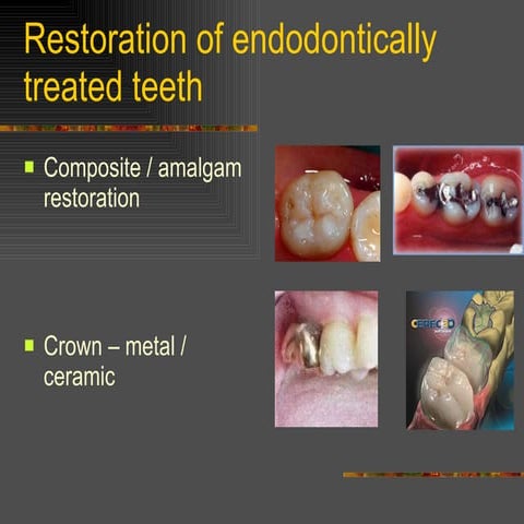 Endo crown | PPTX
