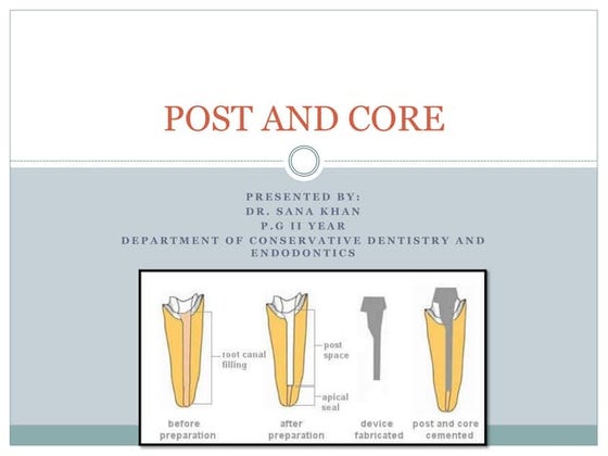 wedge and their technique and prewedging | PPT
