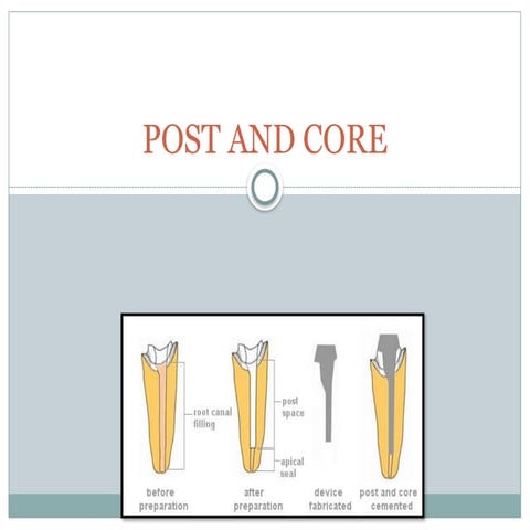 SELUK BELUM DOWEL CROWN DAN CARA PREPARASINYA.pptx