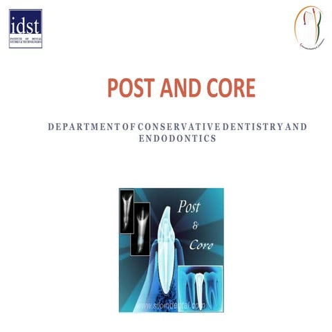 POST & CORE.ppt